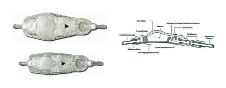 Medtronic PS Medical Delta Valves - The ISPN Guide to Pediatric ...