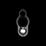 Medtronic PS Medical Adjustable Strata Valves - ISPN Guide