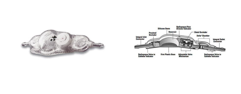 Medtronic PS Medical Adjustable Strata Valves - The ISPN Guide to ...