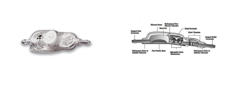 Medtronic PS Medical Adjustable Strata Valves - The ISPN Guide to ...