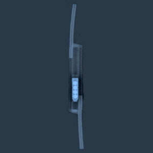 The ISPN Shunt Guide - The ISPN Guide to Pediatric Neurosurgery